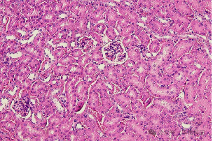 Unilateral Ureteral Obstruction (UUO) Model